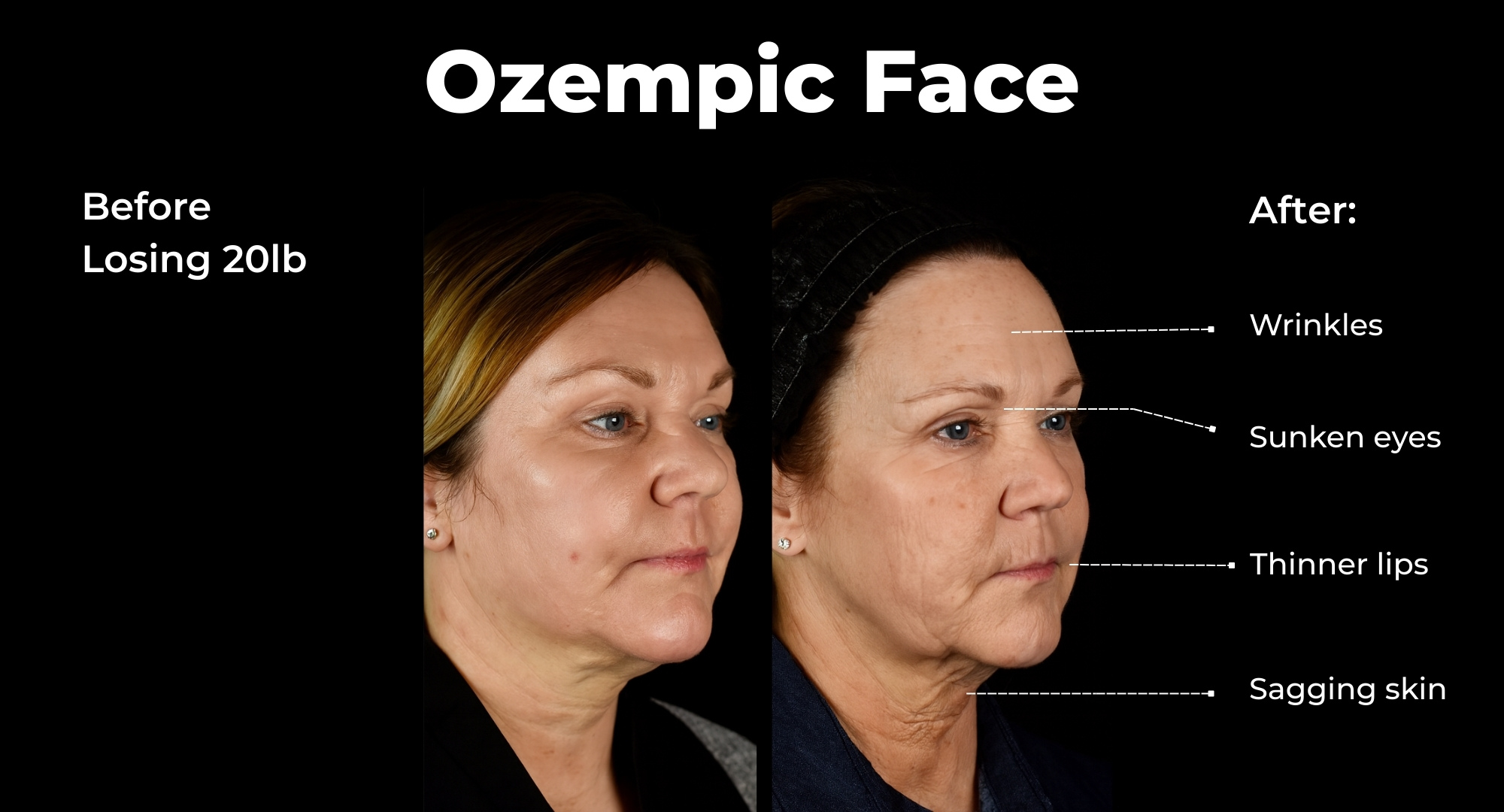 NAD Age Defense Moisturizer And Serum Sample For Ozempic Face | BrainIQ ...